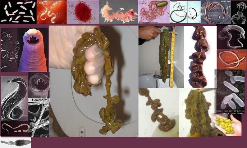 Bowel Colon Cleanser Pills Flush Detox IBS Parasites Digestive Cleanse ...