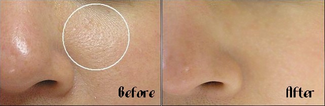 Proper Way of Extraction | Biology Is Fun